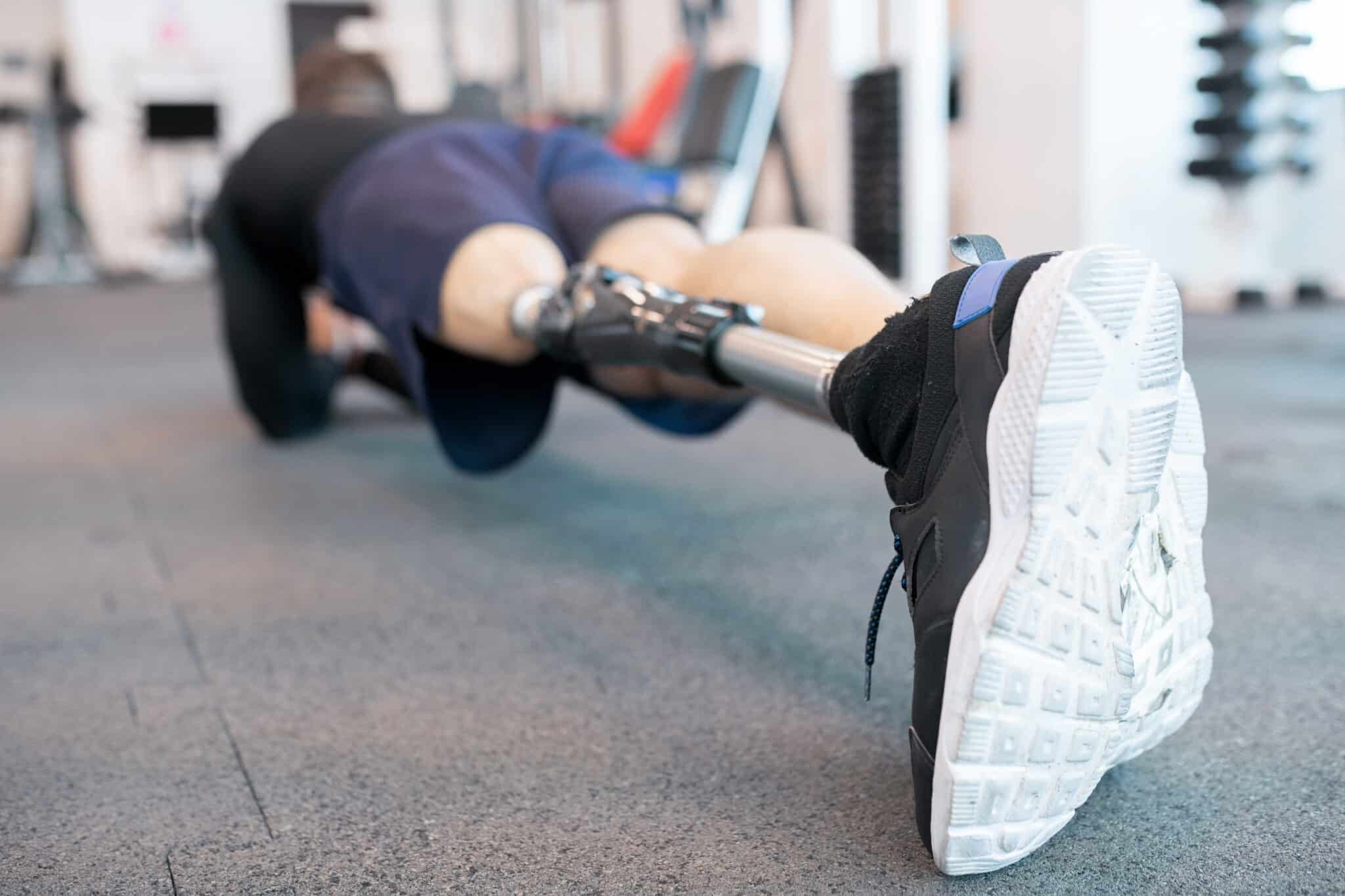 At The Hip Prosthetics | Above & Beyond Orthopedics | Gross Pointe, MI