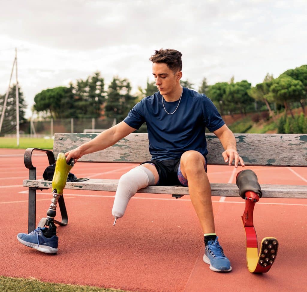 Below Knee Prosthetics | Above & Beyond Orthopedics | Gross Pointe, MI